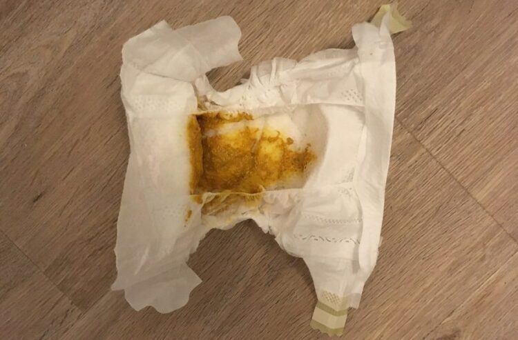 Babypoep onder de loep: van zwarte tot groene ontlasting – 24Baby.nl
